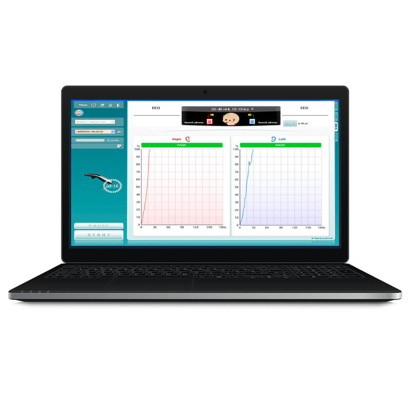 Interacoustics Titan ABRIS | ABR-screening | Diatec Diagnostics