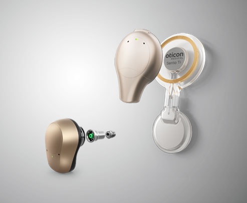 Bone Conduction Hearing | Cochlear Implants | Oticon Medical