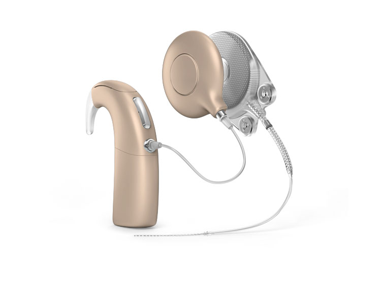 cochlear implants uk